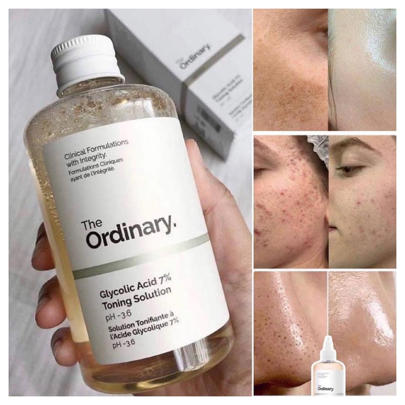 اوردینری تونر گلیکولیک اسید ۲۴۰ میل The Ordinary Glycolic Acid 7% ...